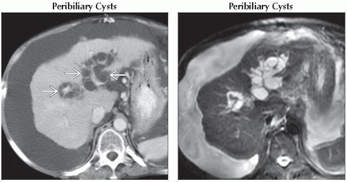 DA9-DB2-Periportal_Lucency_or_Edema-FFU8.gif | Abdominal Key