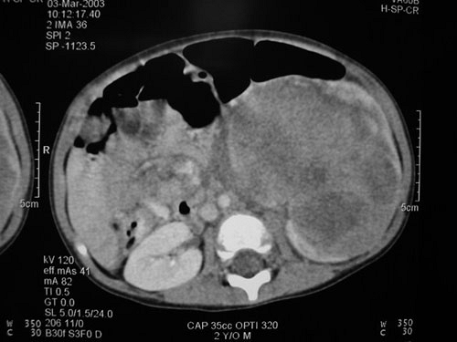 C32-FF2.gif | Abdominal Key