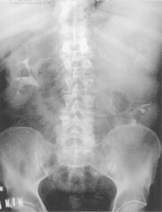 image00822.gif | Abdominal Key