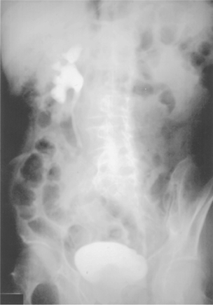 image00826.gif | Abdominal Key