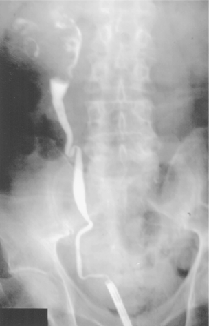 image00828.gif | Abdominal Key