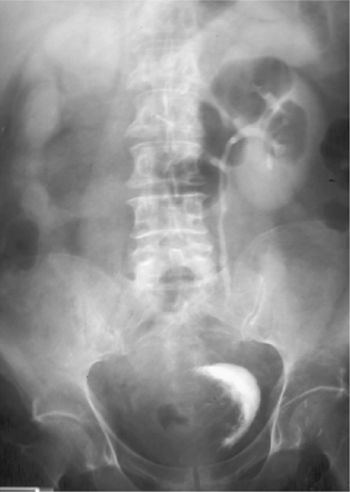 image00829.gif | Abdominal Key