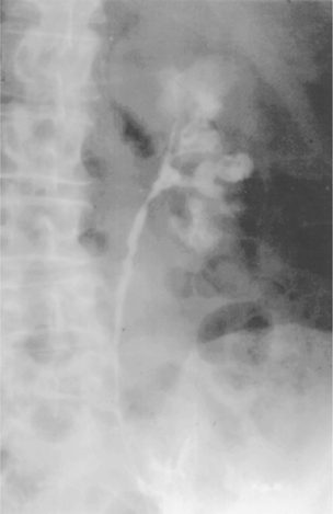 image00831.gif | Abdominal Key