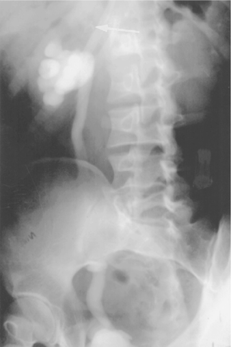 image00832.gif | Abdominal Key