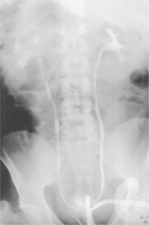 image00833.gif | Abdominal Key