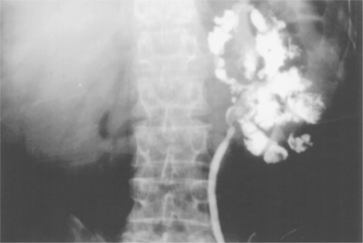 image00836.gif | Abdominal Key