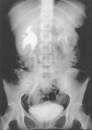 image00838.gif | Abdominal Key