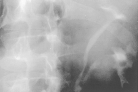 image00839.gif | Abdominal Key