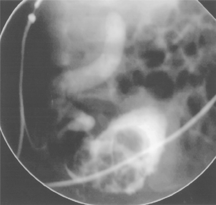 image00854.gif | Abdominal Key