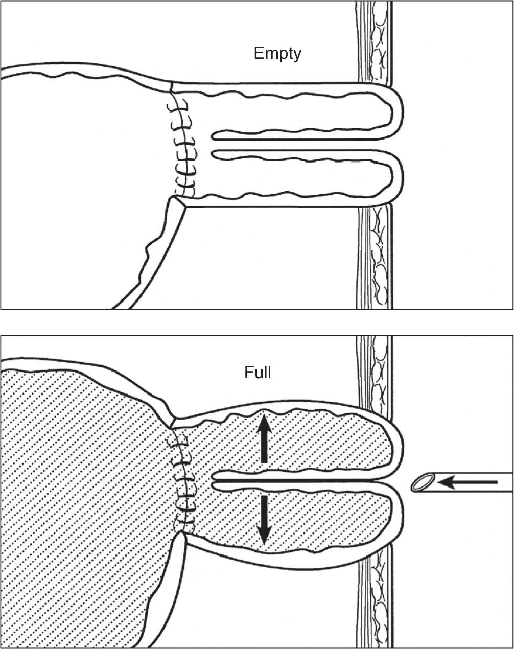 image00870.jpeg | Abdominal Key