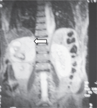 image00910.gif | Abdominal Key