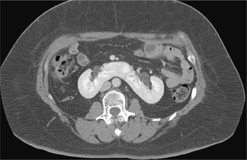 image00912.gif | Abdominal Key