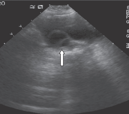 image00915.gif | Abdominal Key