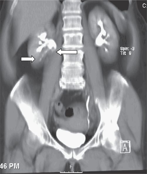image00916.jpeg | Abdominal Key