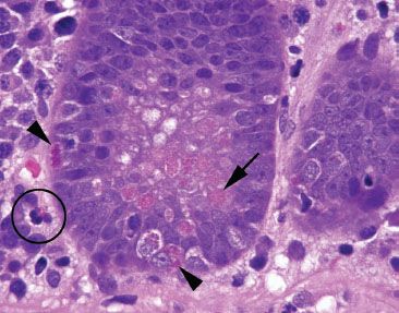 image01438.jpeg | Abdominal Key