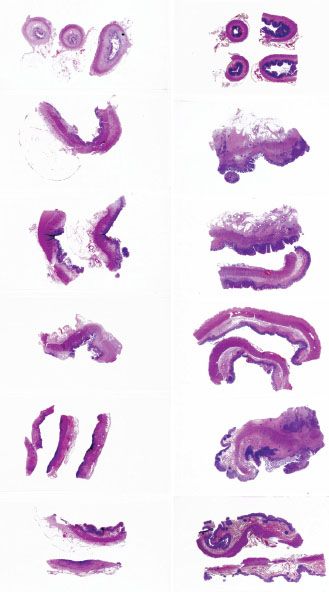 image01471.jpeg | Abdominal Key