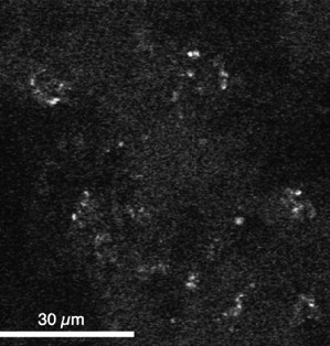 gr2.jpg | Abdominal Key