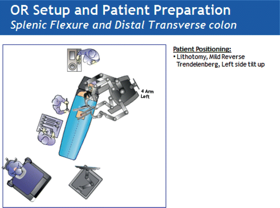 Robotic Total Colectomy Abdominal Key