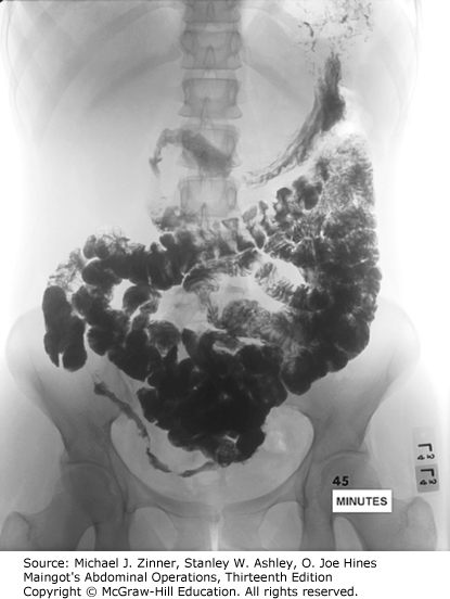 m_zinner_ch45_f001.png | Abdominal Key