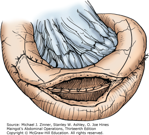 m_zinner_ch45_f009.png | Abdominal Key
