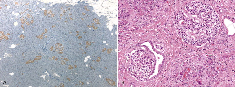 f036-026ab-9781455707478.jpg | Abdominal Key