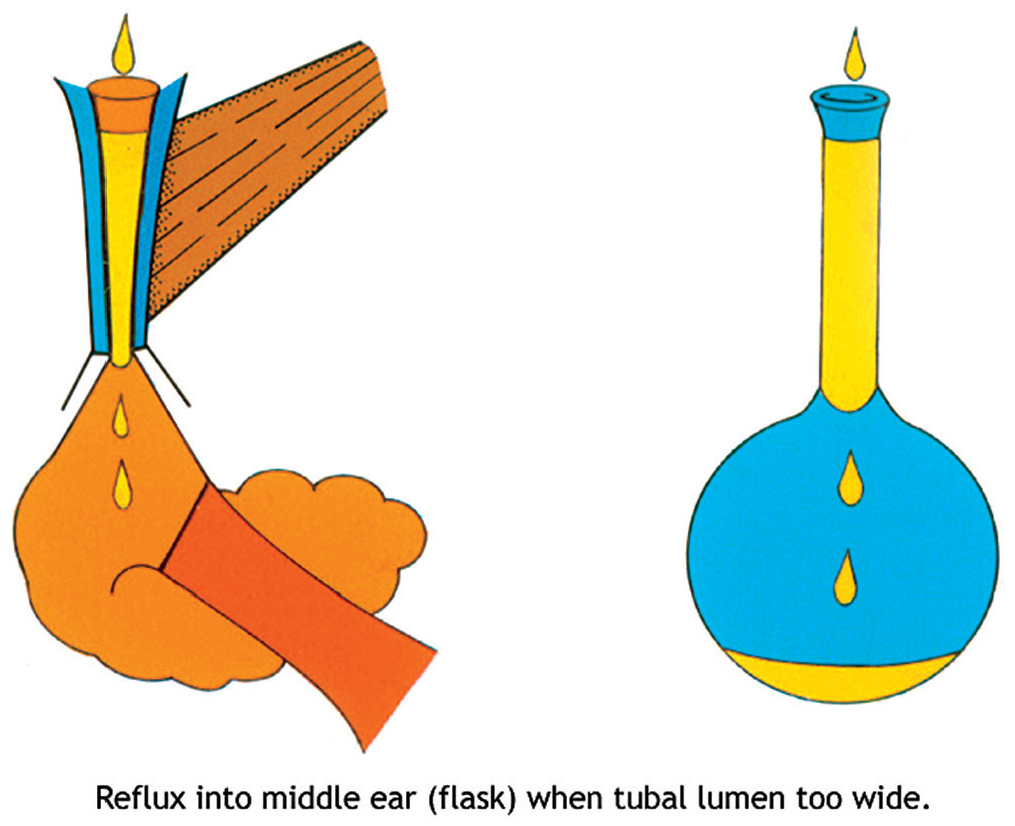f0072-01.jpg | Abdominal Key