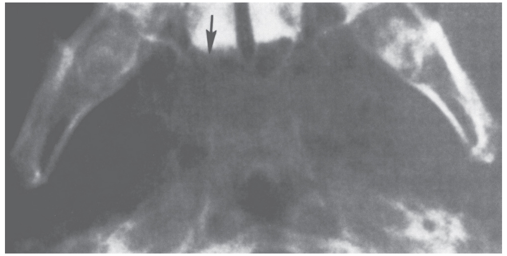 f0076-02.jpg | Abdominal Key