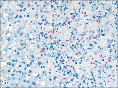 f007-033b-9780702066979.jpg | Abdominal Key