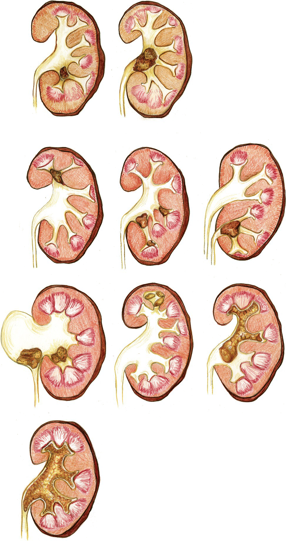 c07f001.gif | Abdominal Key
