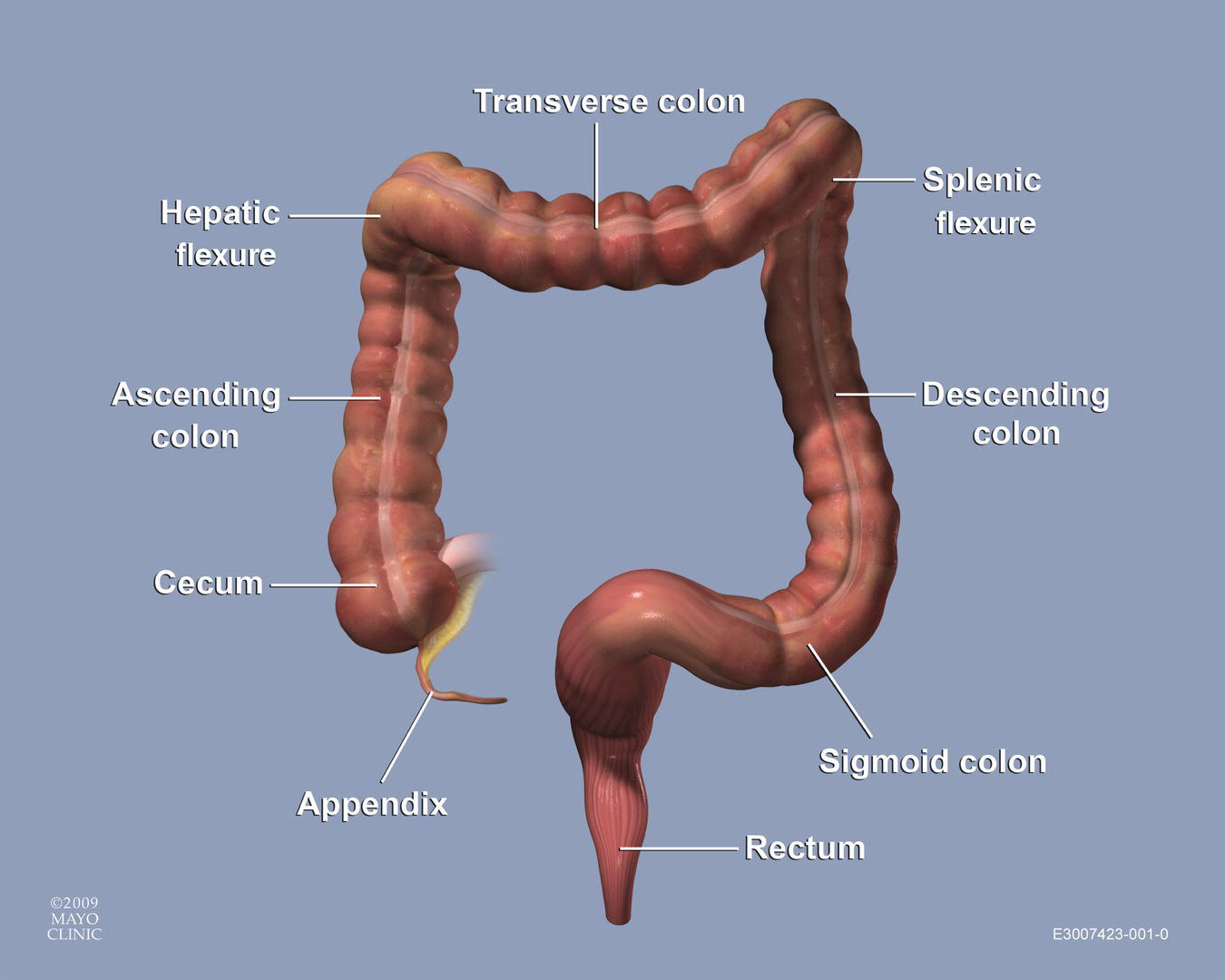 Splenic Flexure Colonoscopy
