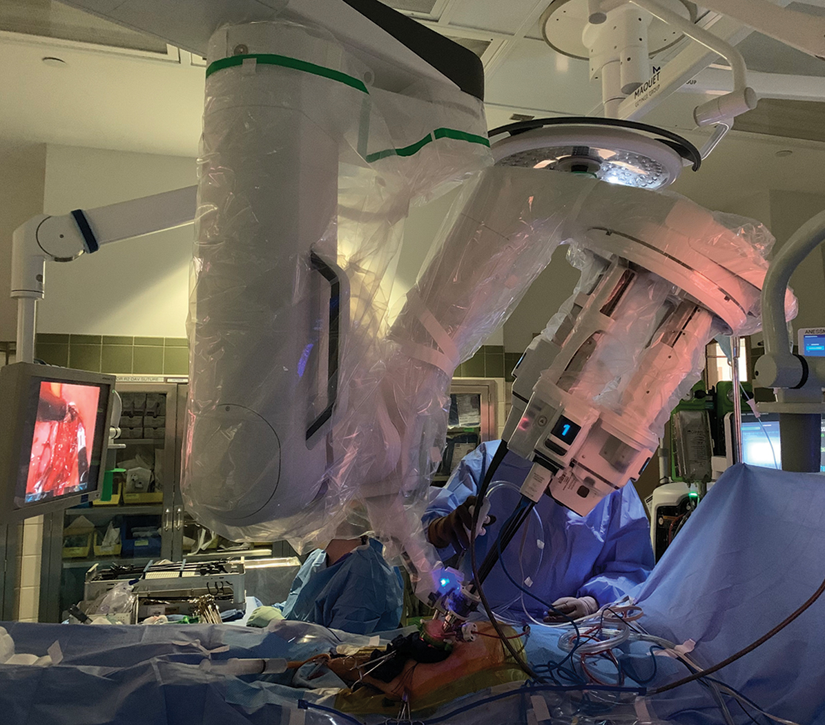 Extraperitoneal Robotic Assisted Radical Prostatectomy Abdominal Key